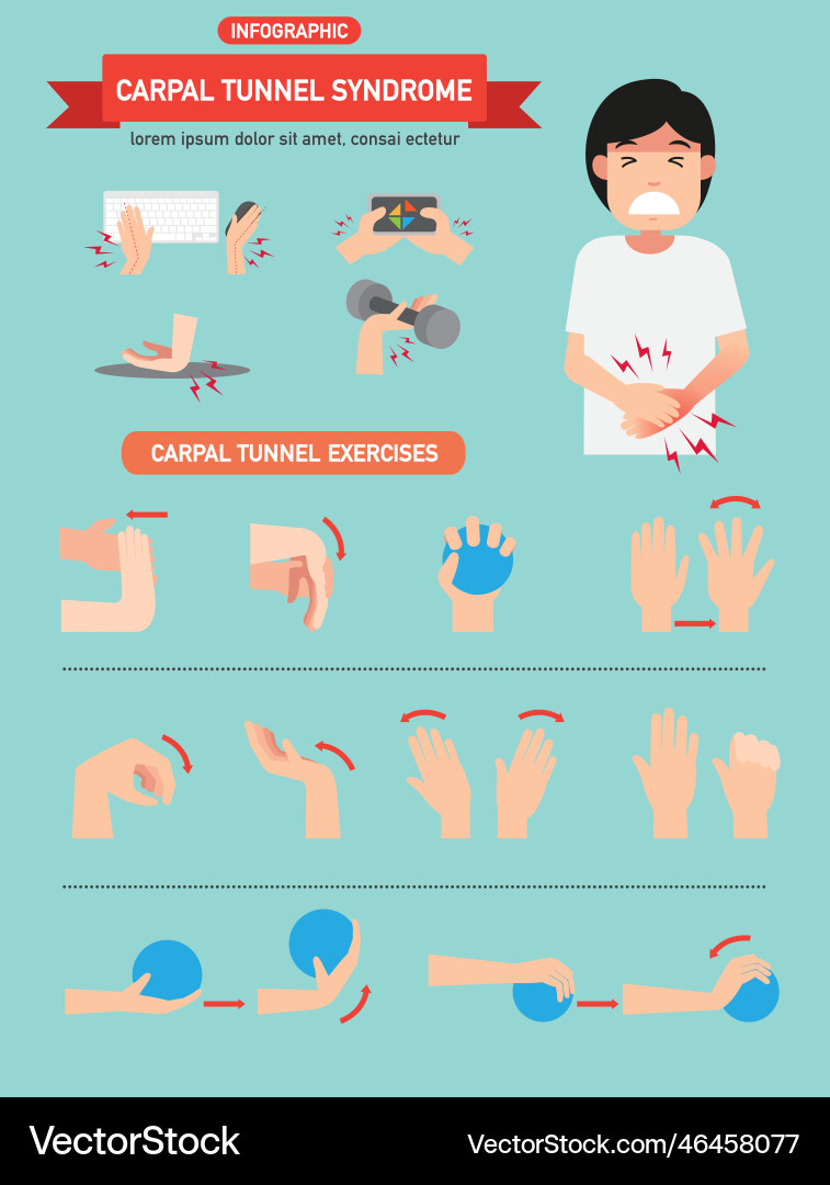Carpal tunnel syndrome infographic Royalty Free Vector Image