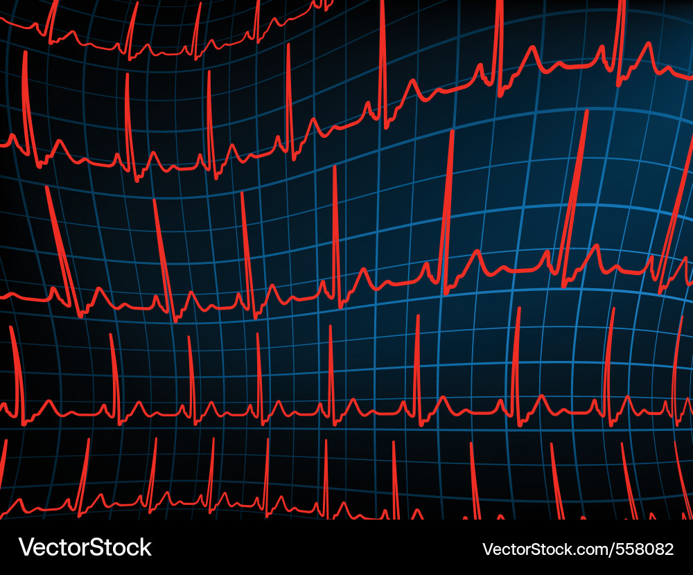 Ecg tracing monitor Royalty Free Vector Image - VectorStock