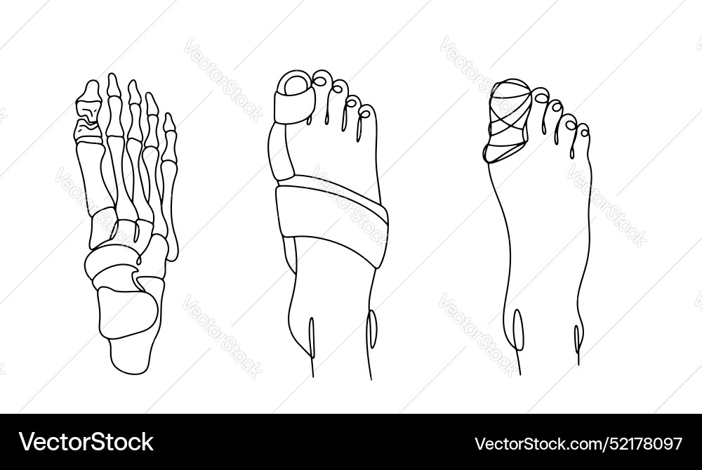 Broken toe Royalty Free Vector Image - VectorStock