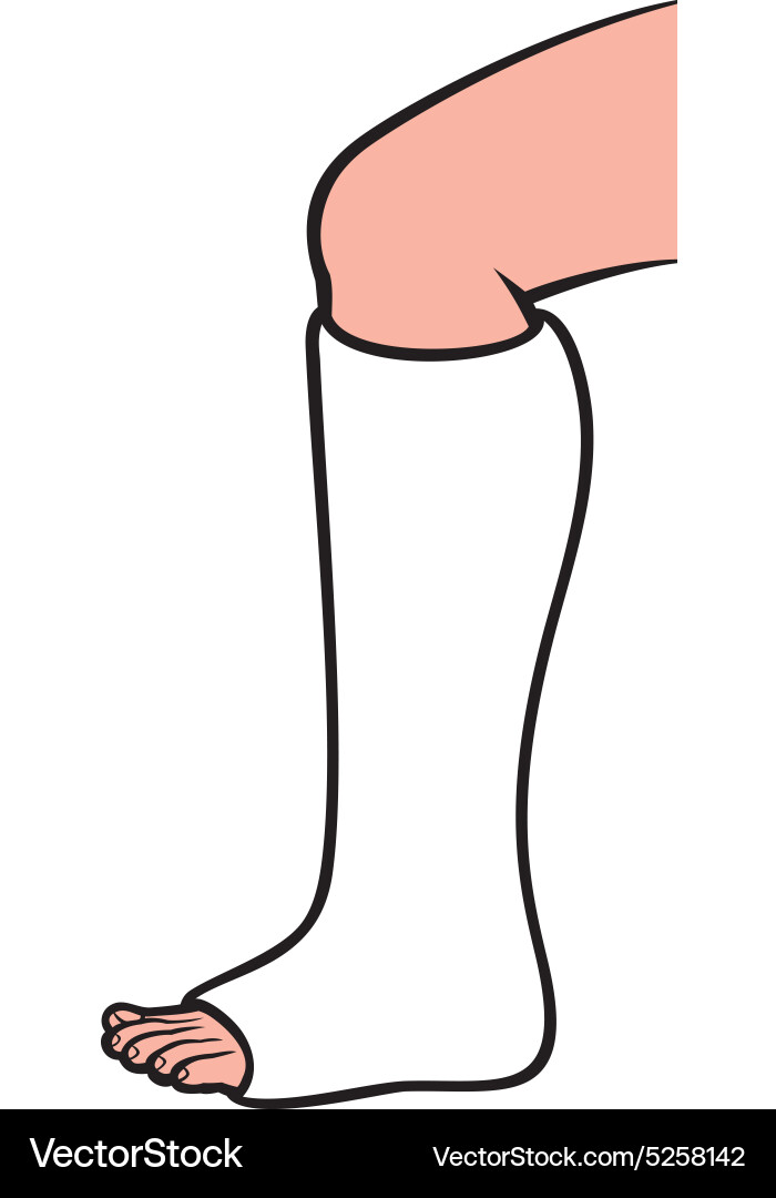 Short leg cast Royalty Free Vector Image - VectorStock