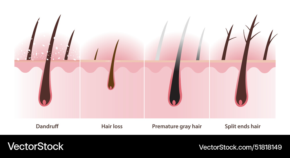 Cross section of hair problems Royalty Free Vector Image