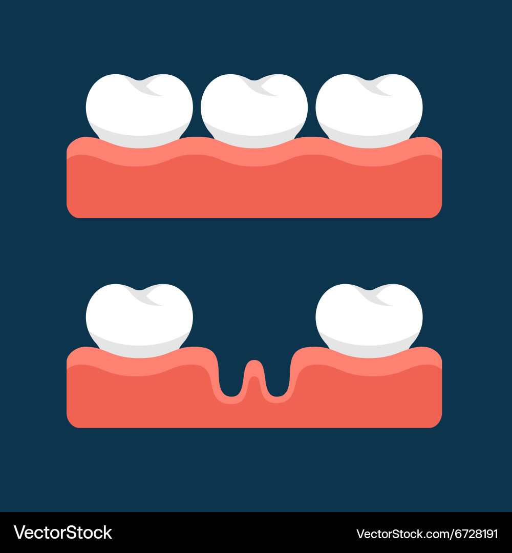 Teeth with gum for healthcare Royalty Free Vector Image