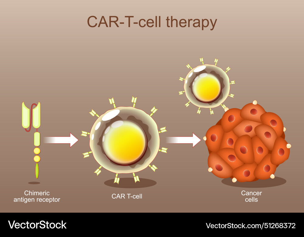 Car-t cell therapy cancer immunotherapy chimeric Vector Image