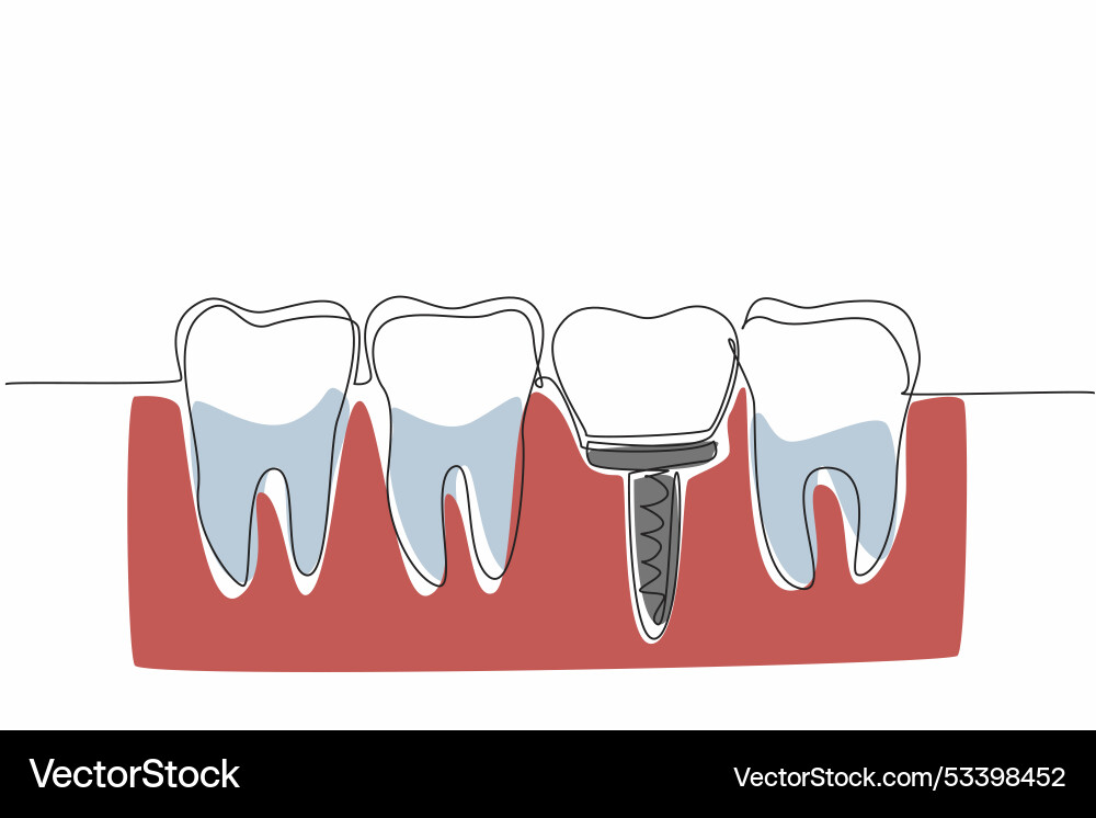 Continuous one line drawing teeth are aligned Vector Image