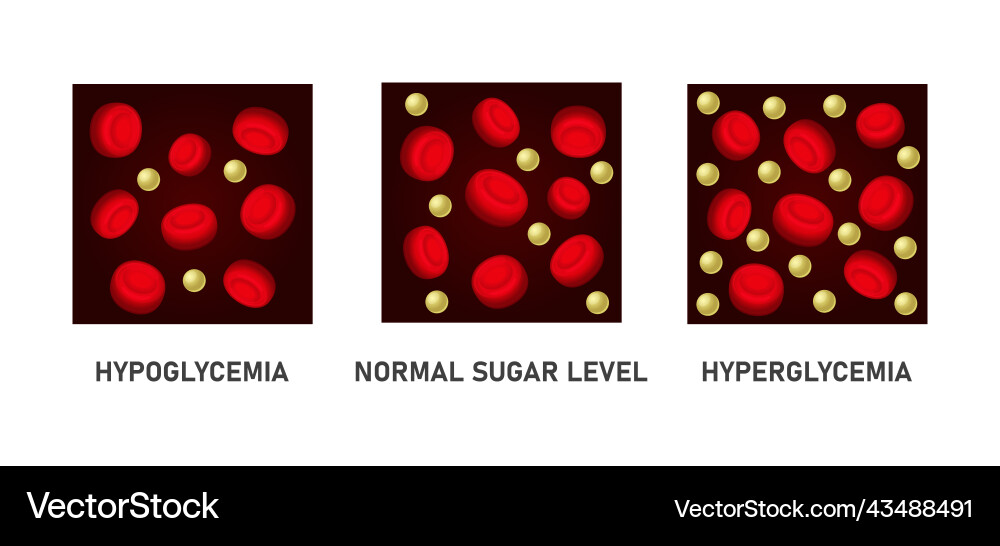 Glucose blood sugar level set hypoglycemia Vector Image
