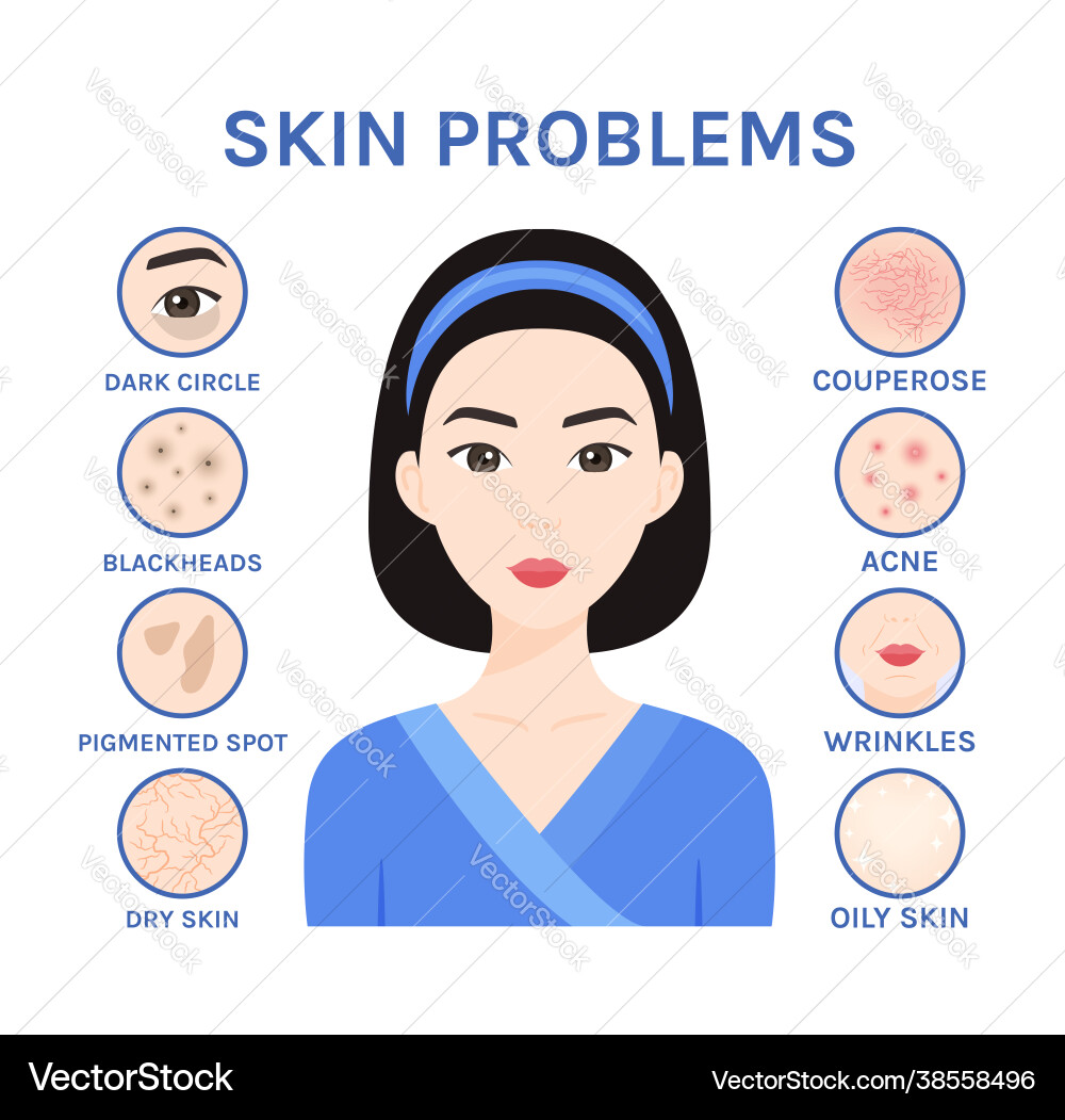 Isolated asian woman and types skin problems Vector Image