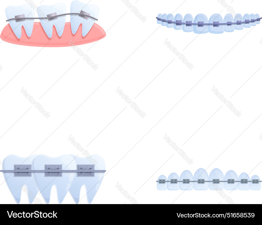 Brace system icons set cartoon orthodontic Vector Image