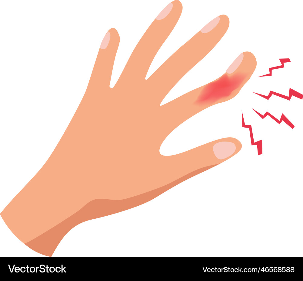 Flat finger injury Royalty Free Vector Image - VectorStock