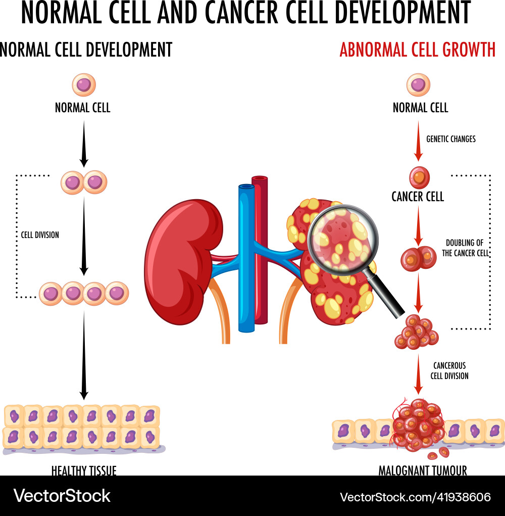 Diagram showing cancer development process Vector Image