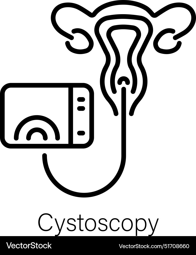 Cystoscopy Royalty Free Vector Image - VectorStock
