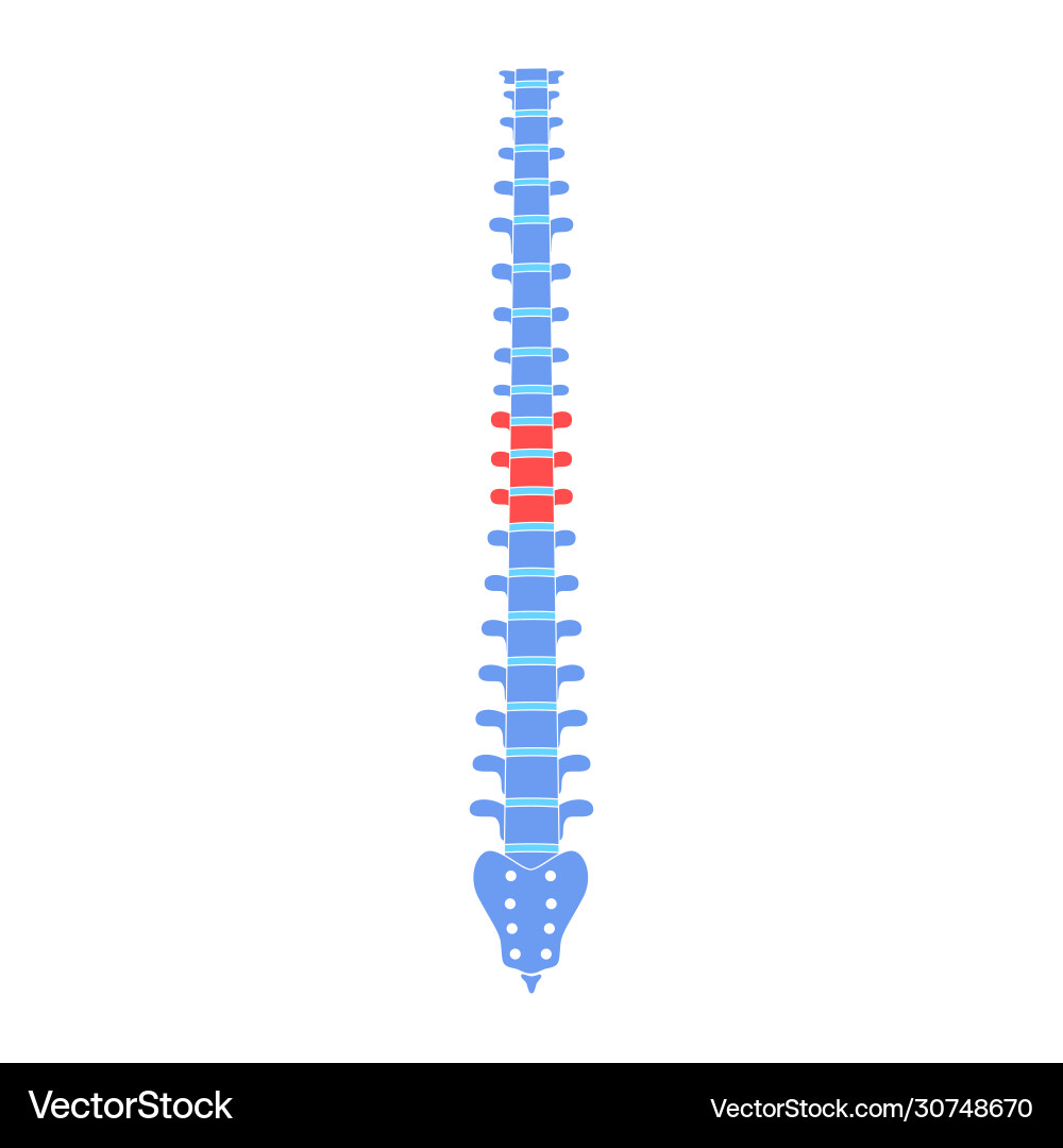 Human spine pain Royalty Free Vector Image - VectorStock
