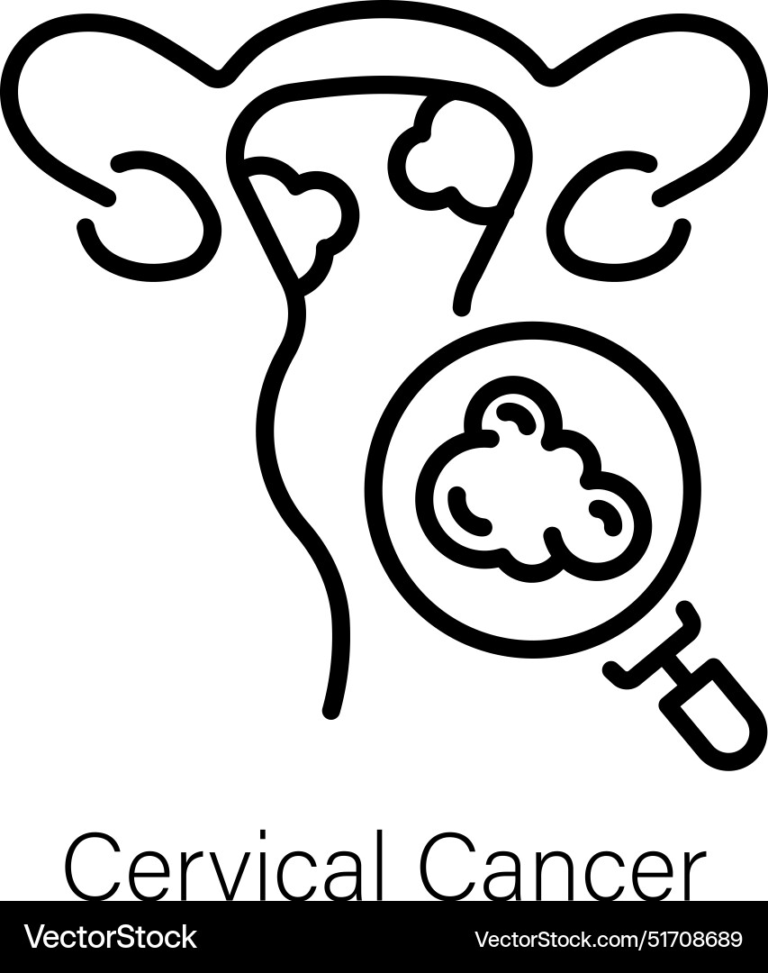 Cervical Cancer Royalty Free Vector Image Vectorstock