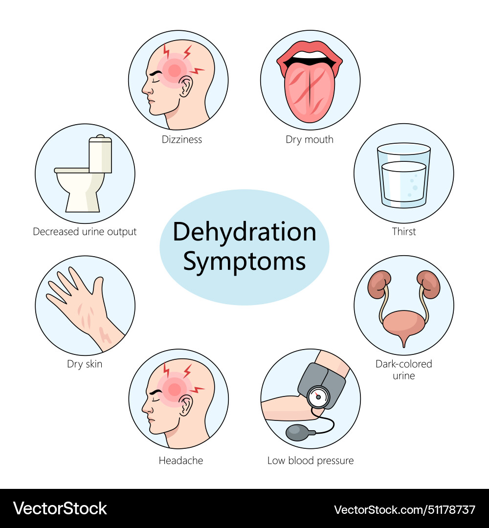 Dehydration symptoms diagram medical science Vector Image
