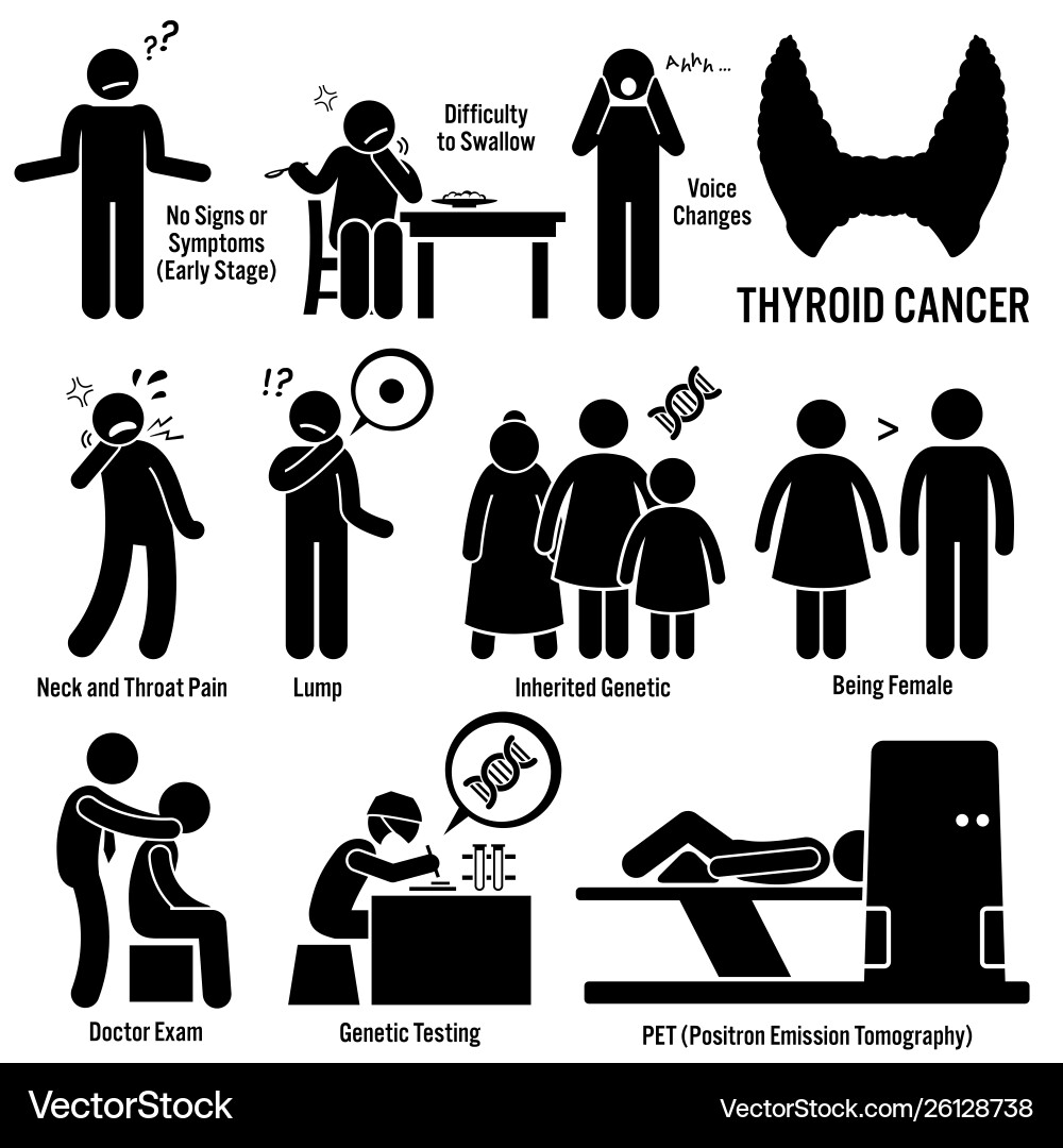 Thyroid cancer symptoms causes risk factors Vector Image
