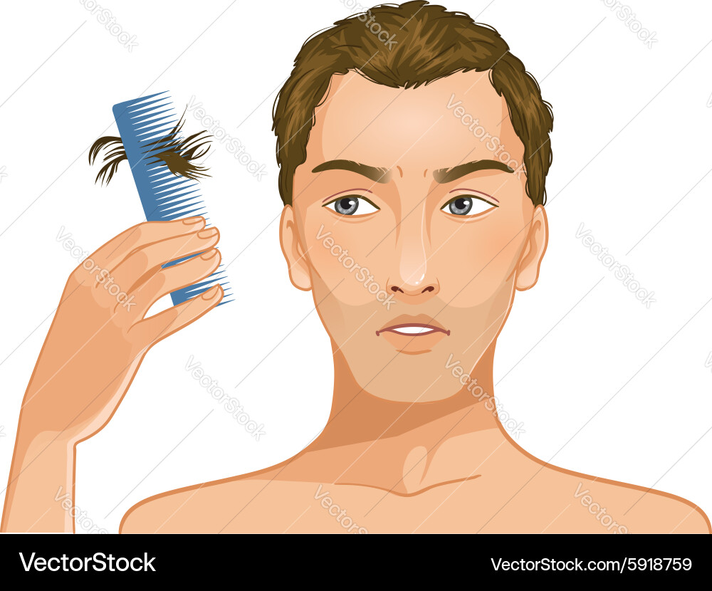 Young man with hair fall eps10 Royalty Free Vector Image