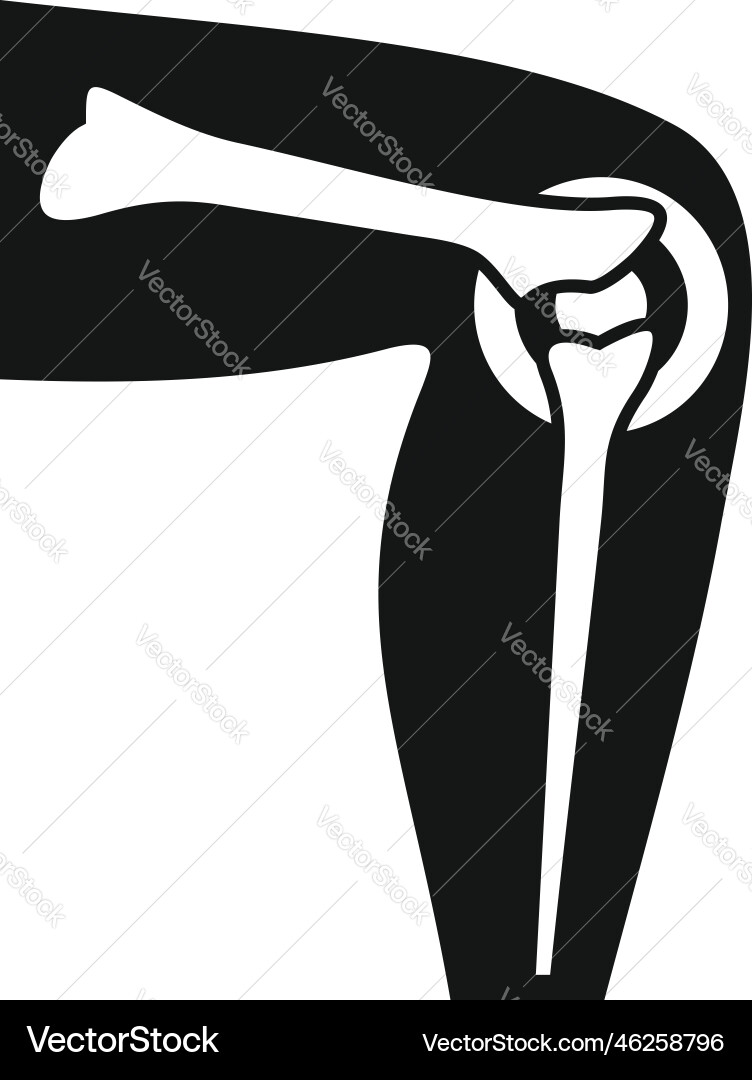 Knee Pain Icon - Joint Injury Royalty Free Vector Image