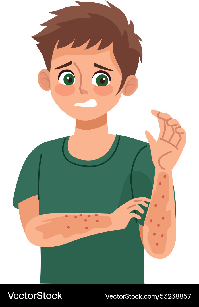 Young man with monkeypox virus infection Vector Image
