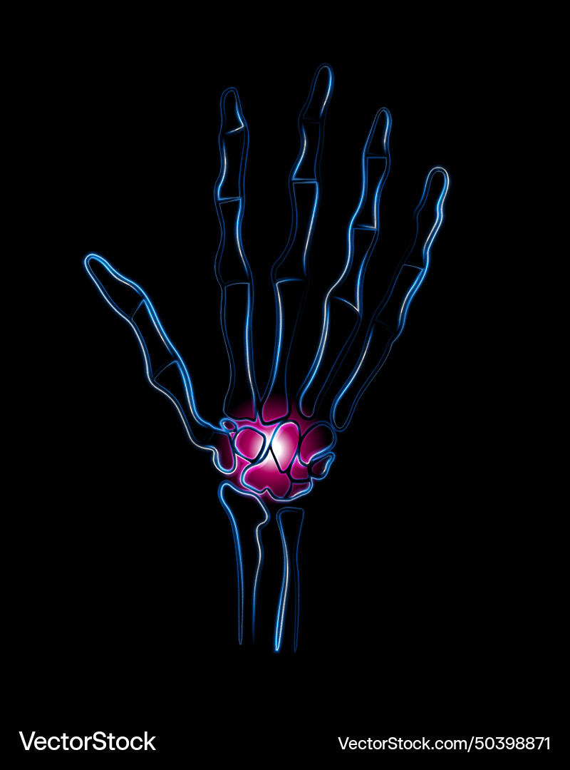 Wrist pain hand with localization Royalty Free Vector Image