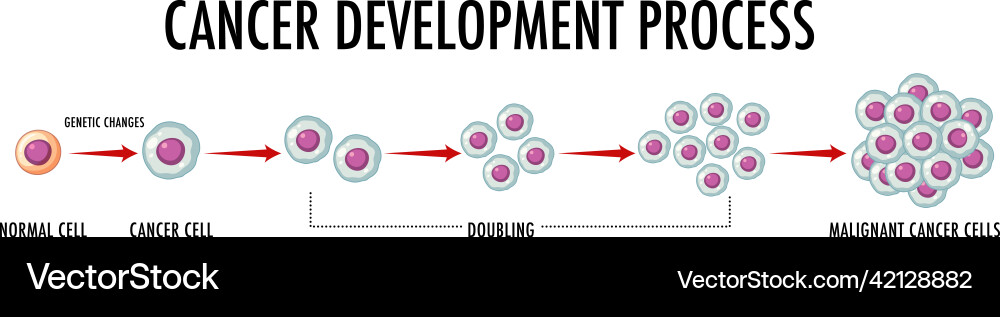 Cancer development process infographic Royalty Free Vector