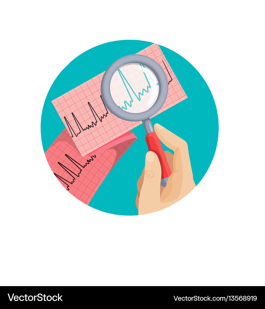 Atrial Fibrillation ECG Analysis Royalty Free Vector Image