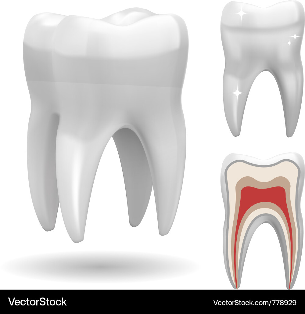 Dental Cavity Illustration Royalty Free Vector Image