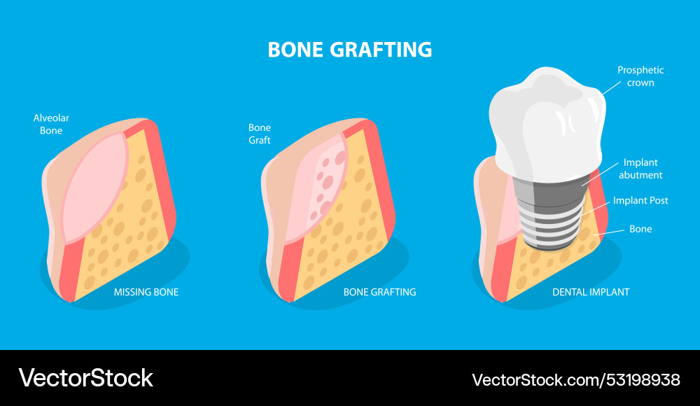3d isometric flat of bone Royalty Free Vector Image