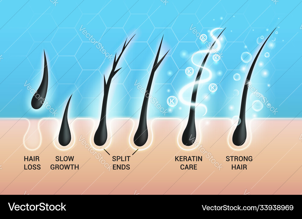 Different hair problems and deep salon treatment Vector Image