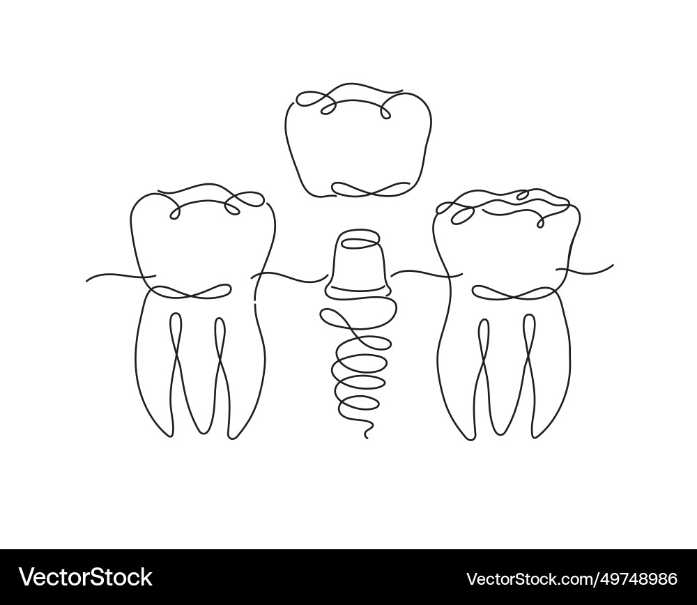 Teeth implant flat line white color Royalty Free Vector