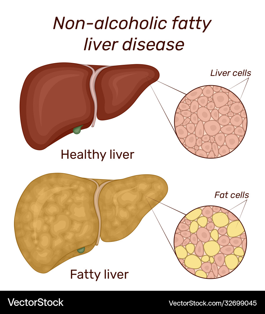 Pathology Vector Images (over 12,000)