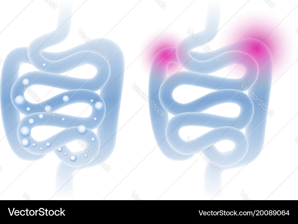 Colon Anatomy Vector Images (over 5,500)