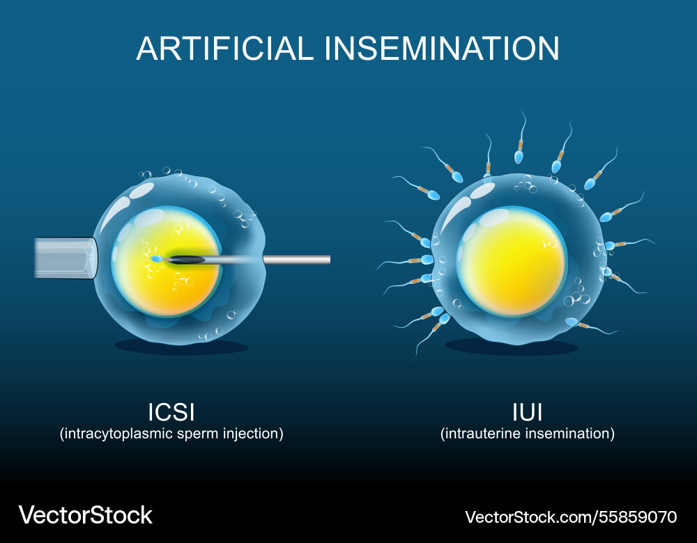 Iui Vector Images (83)
