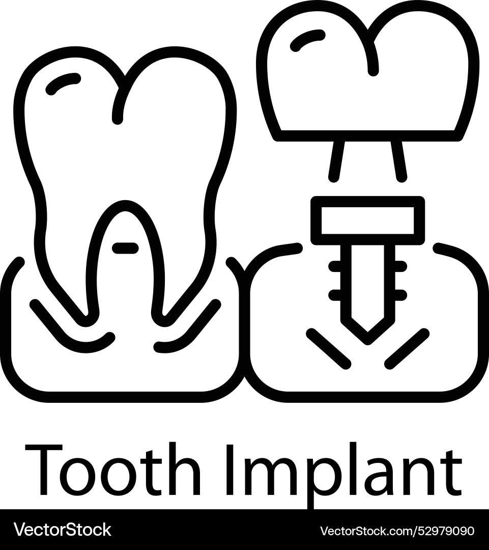 Tooth implant Royalty Free Vector Image - VectorStock
