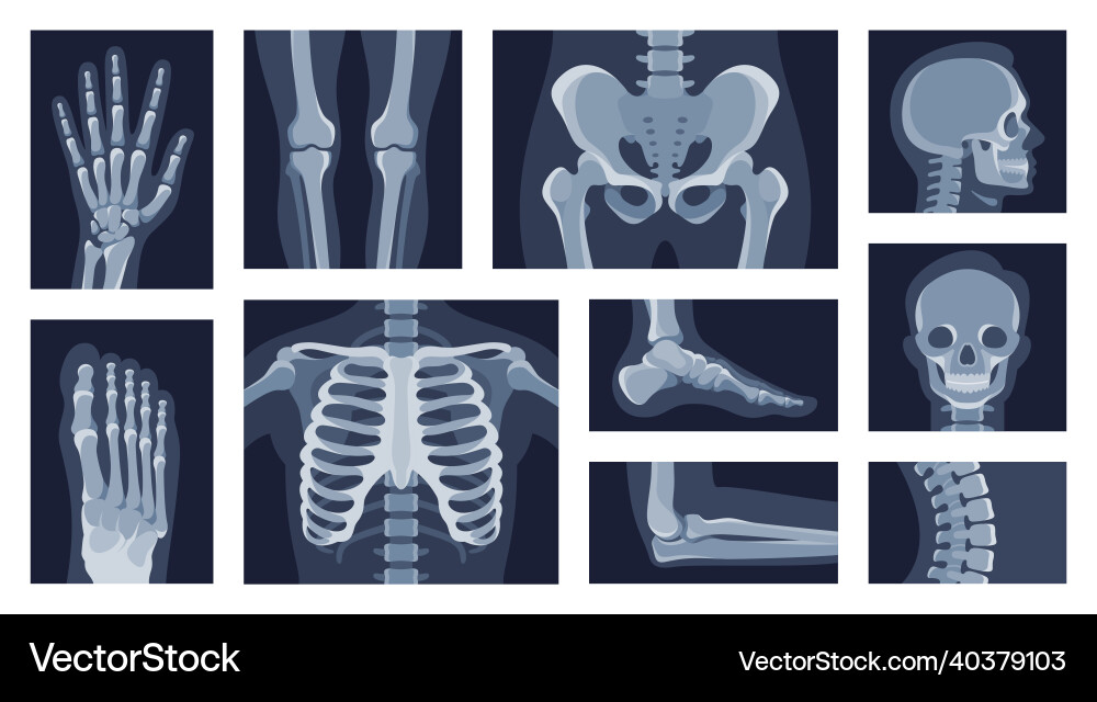 Collection different human body parts roentgen Vector Image