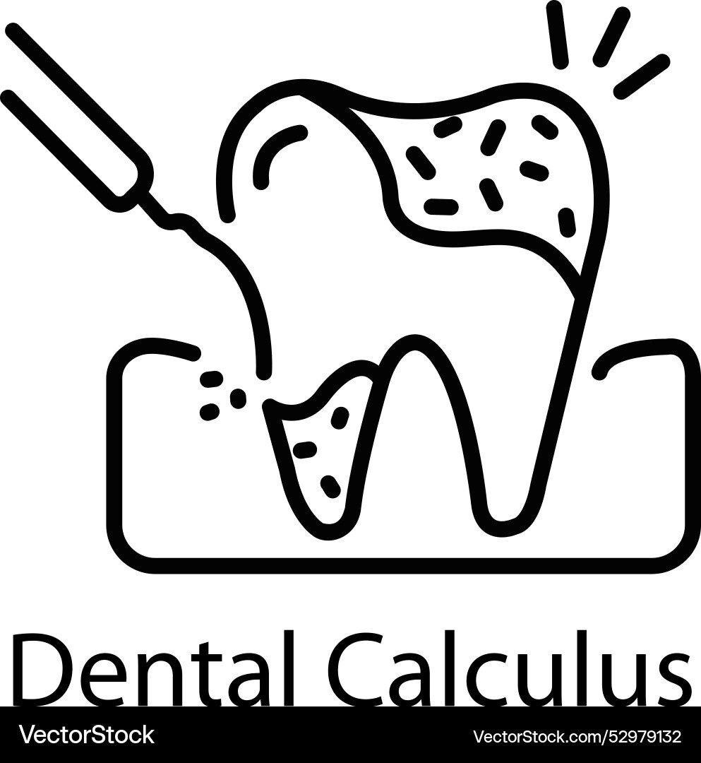 Dental calculus Royalty Free Vector Image - VectorStock