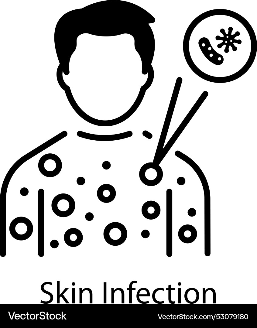 Skin infection Royalty Free Vector Image - VectorStock