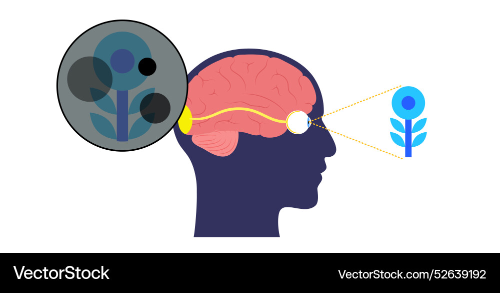 Glaucoma eye disease – Royalty-Free Vector | VectorStock