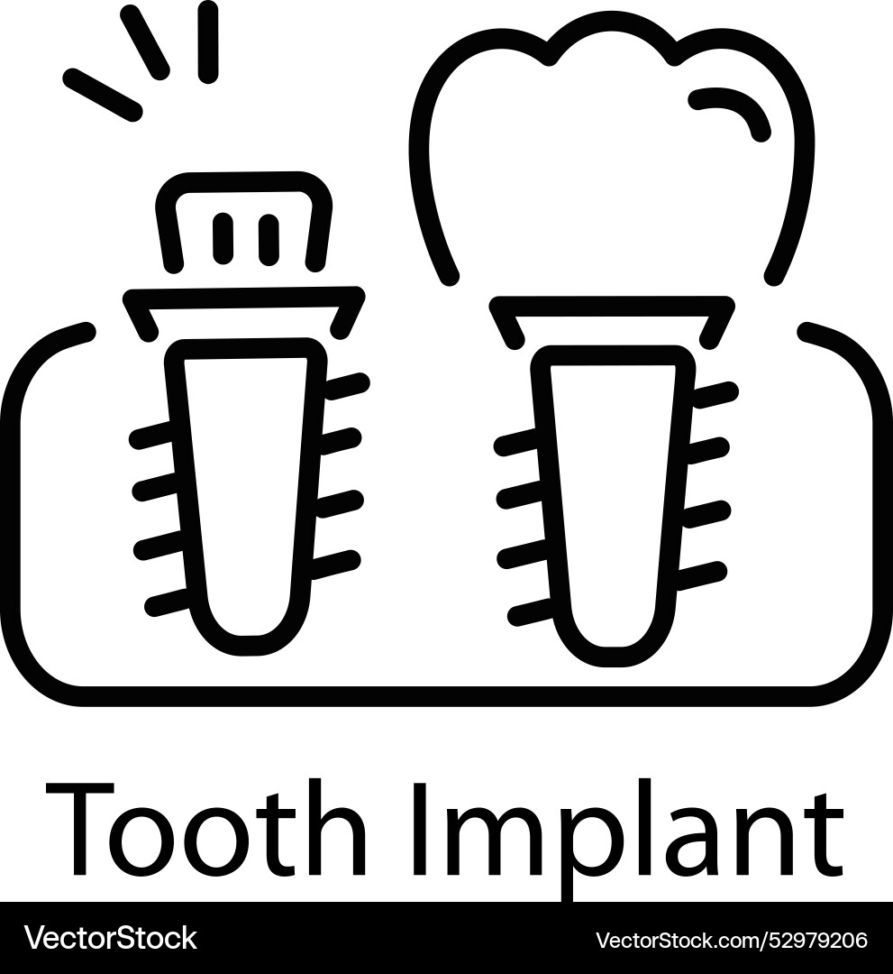 Tooth implant Royalty Free Vector Image - VectorStock