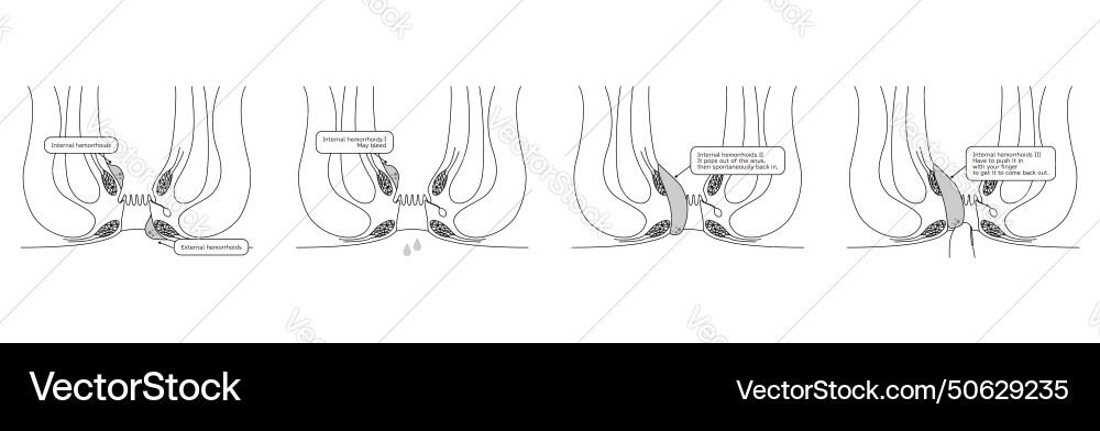 Cross Sectional View Royalty Free Vector Image