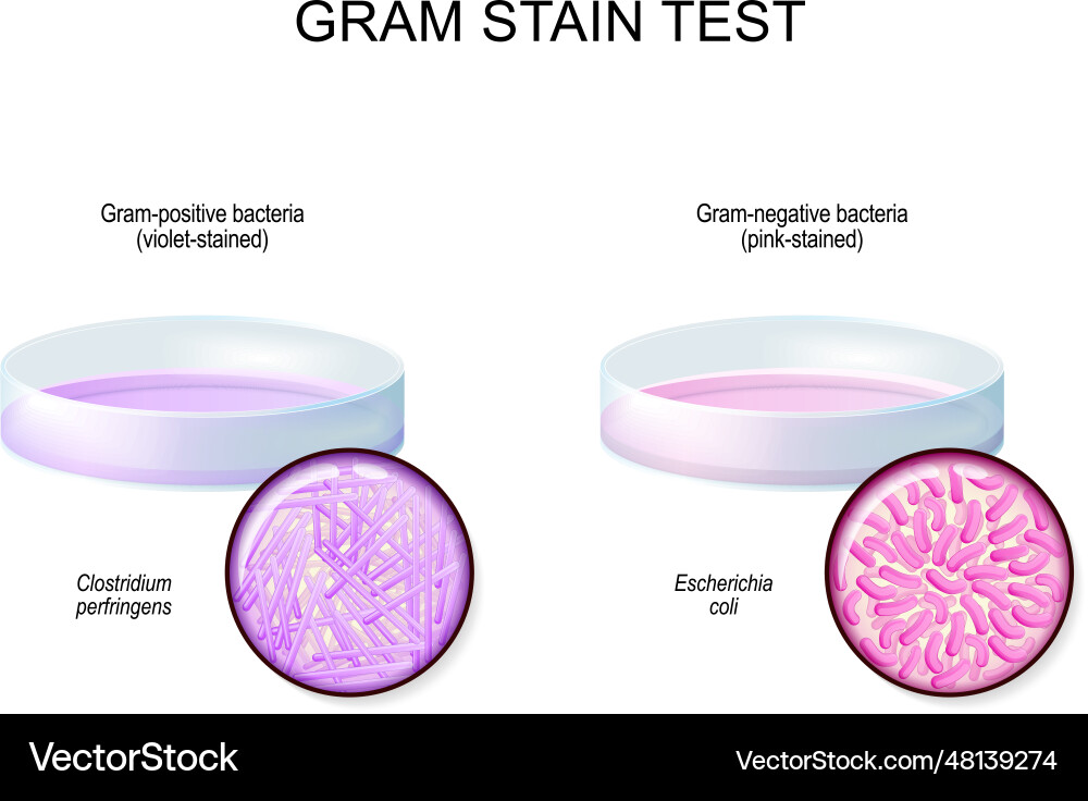 Gram Staining Vector Images (81)