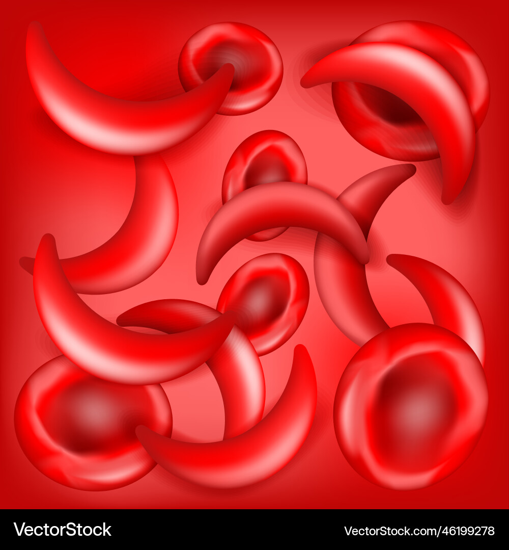 Sickle cell disease scd red background anemia Vector Image