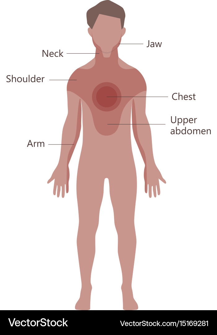 Upper Chest Pain Map Chest Pain Location. | Download Scientific