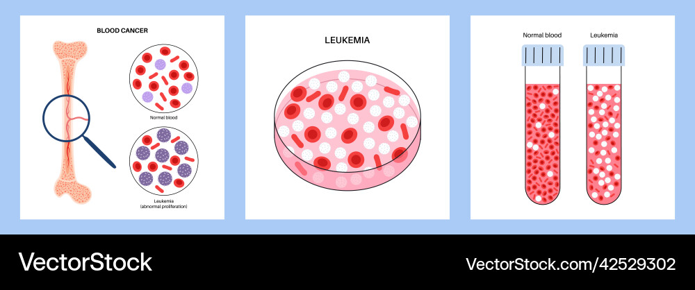 Leukemia blood cancer Royalty Free Vector Image