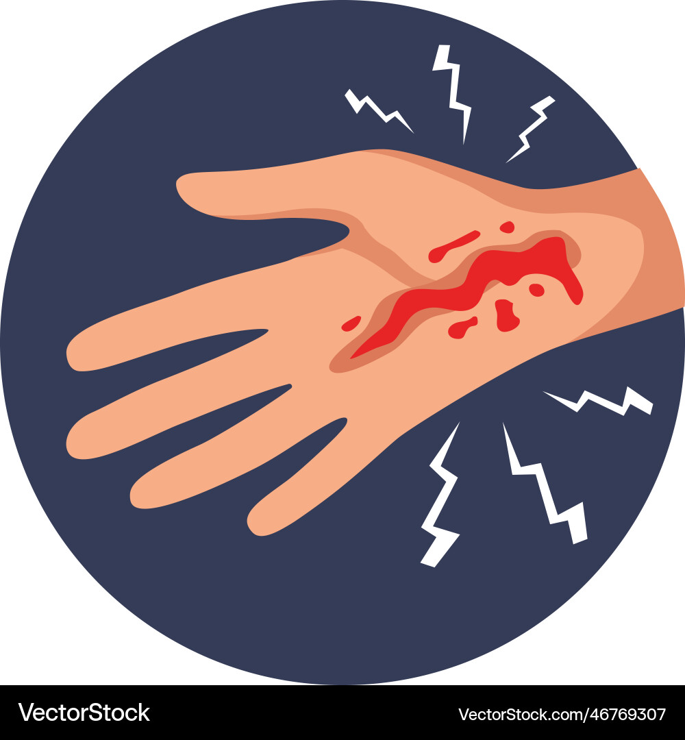 Hand Injury Icon - Bleeding Cut Royalty Free Vector Image