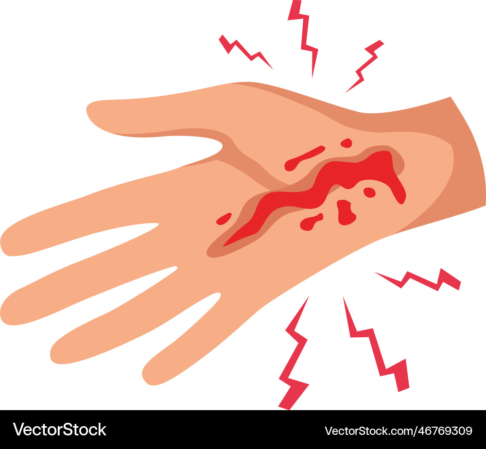 Bleeding Hand Injury Flat Icon Royalty Free Vector Image