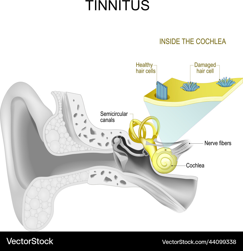 Tinnitus and Human Ear Anatomy Royalty Free Vector Image