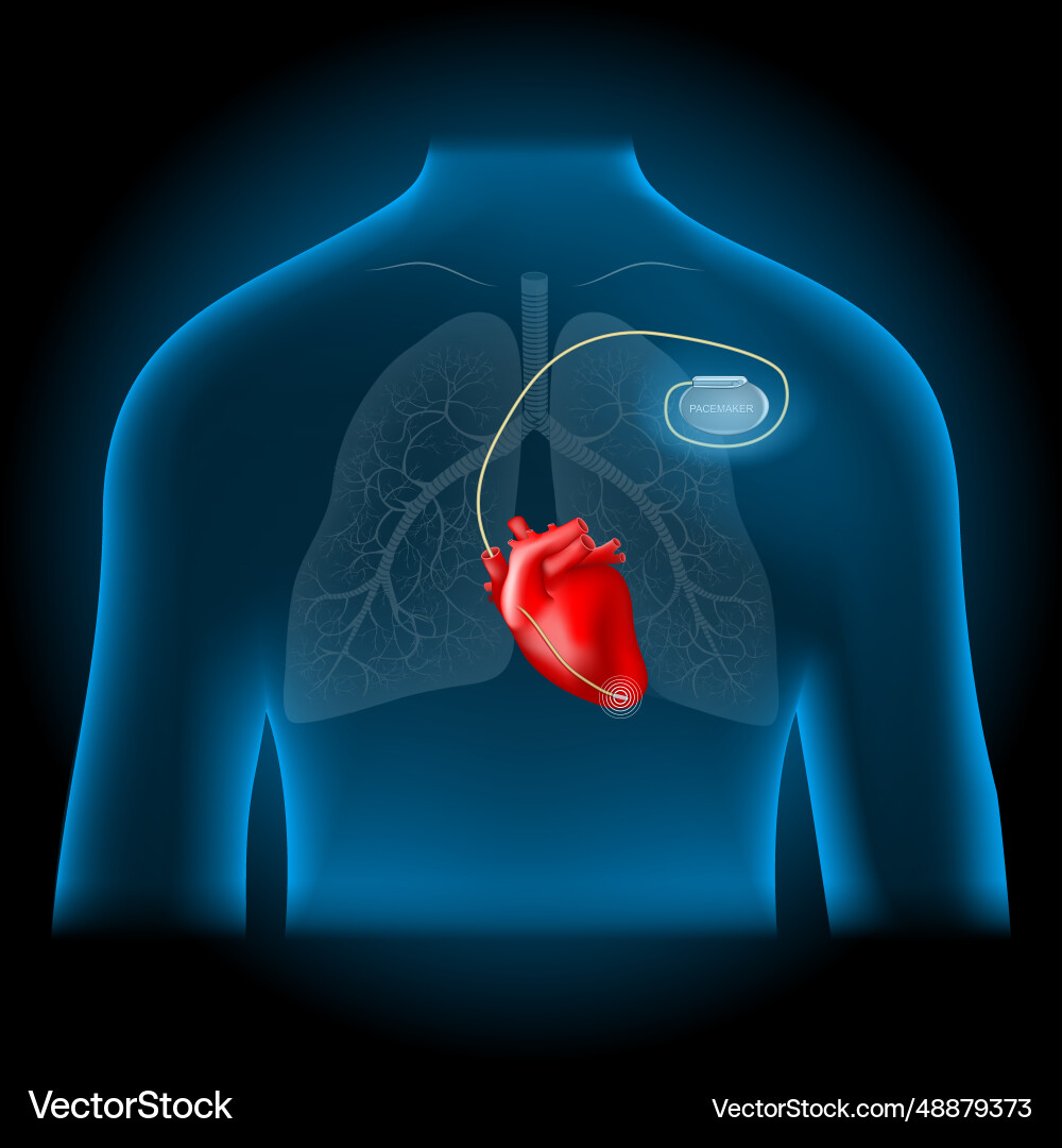 Cardiac pacemaker location Royalty Free Vector Image