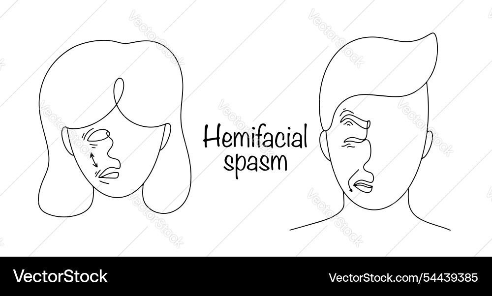 Hemifacial spasm Royalty Free Vector Image - VectorStock