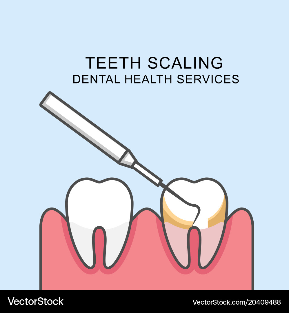 Teeth scaling icon - tooth Royalty Free Vector Image