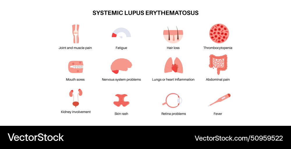 Systemic lupus erythematosus Royalty Free Vector Image