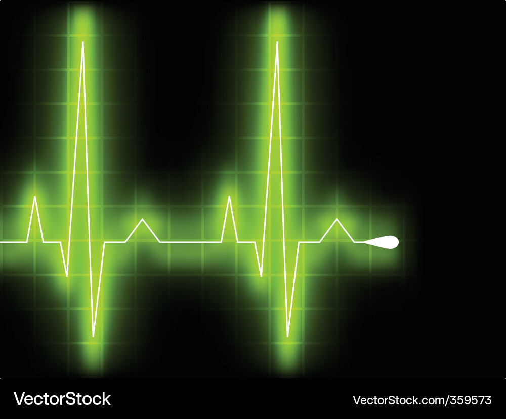 Heart beat graph Royalty Free Vector Image - VectorStock